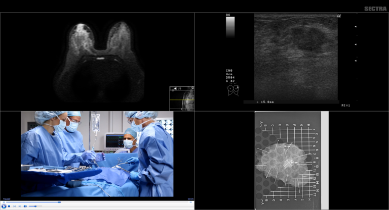 Sectra Breast Imaging PACS and RIS | Sectra Medical