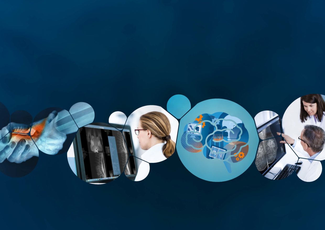 Where radiologists see the added value of machine learning | Sectra Medical