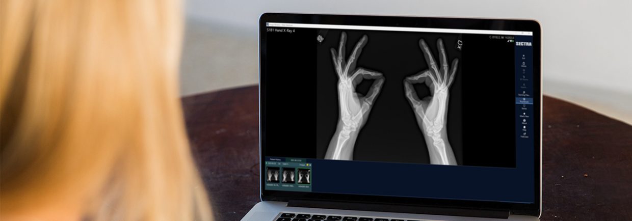 Navigating the challenges of radiography | Sectra Medical